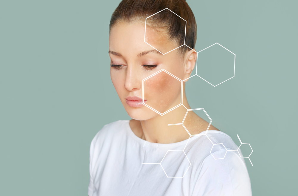 Sun Damage & Brown Spots - Richmond Square Medical